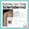 Anatomy Case Study - Scleroderma - Suburban Science