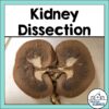Kidney Dissection Lab - Suburban Science